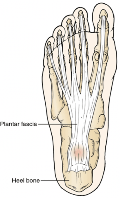 Plantar Fasciitis - Western Montana Foot & Ankle